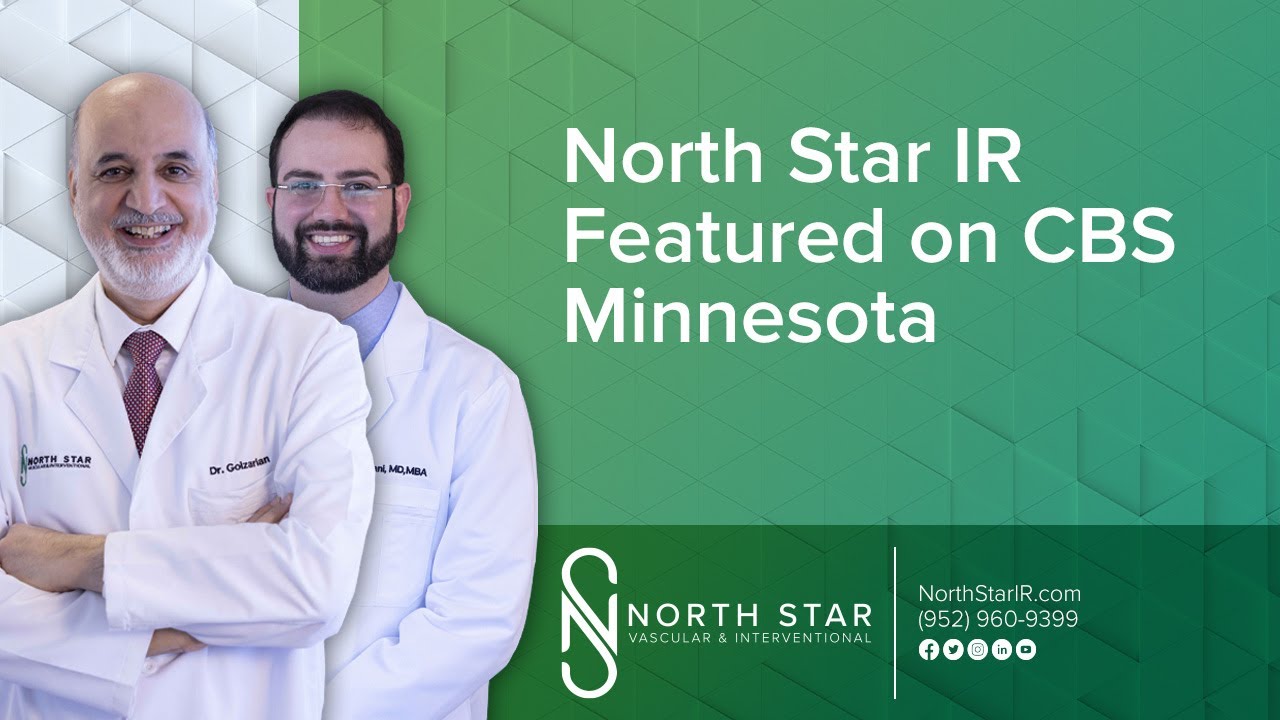 North Star Vascular & Interventional on CBS Minnesota Health - YouTube