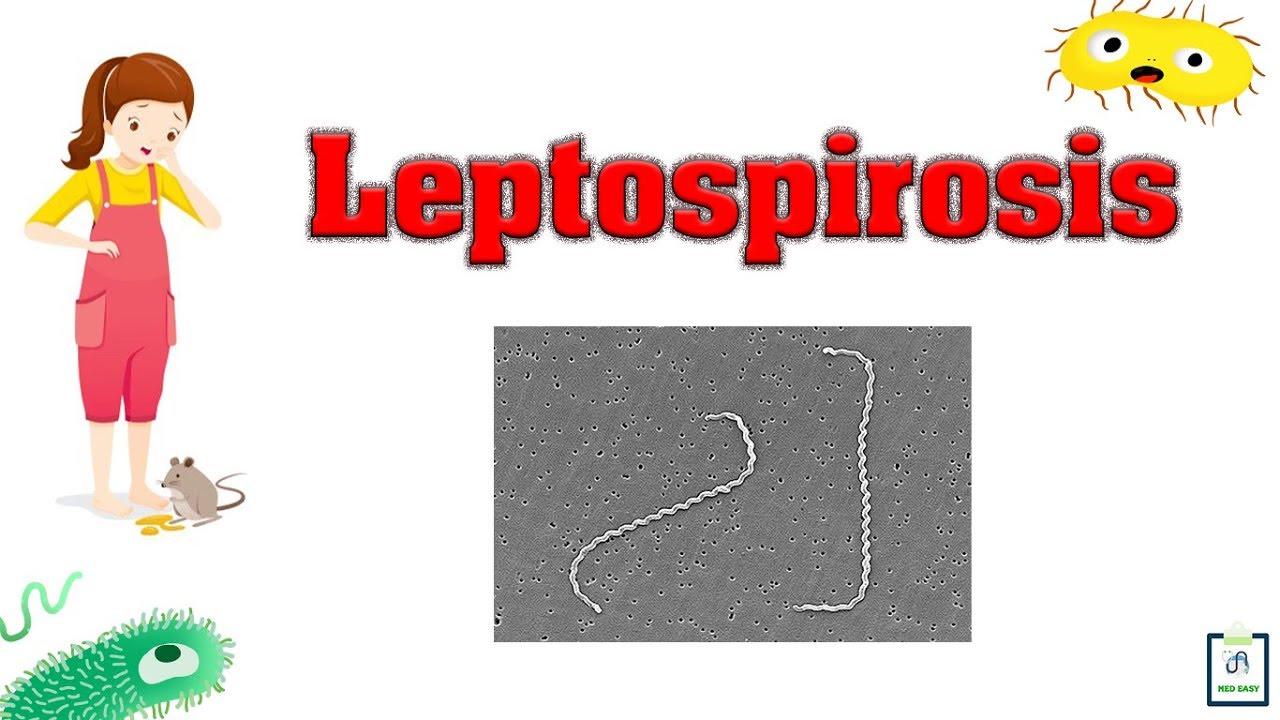 Leptospirosis - Introduction, Causes, Pathophysiology, Symptoms ...