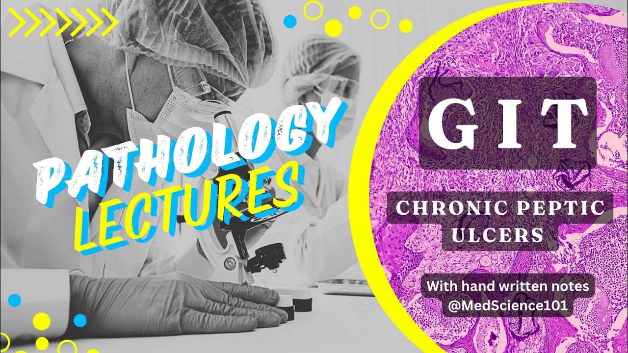 Peptic ulcers pathology (part-2) | pathology lectures #mbbs 2nd year ...