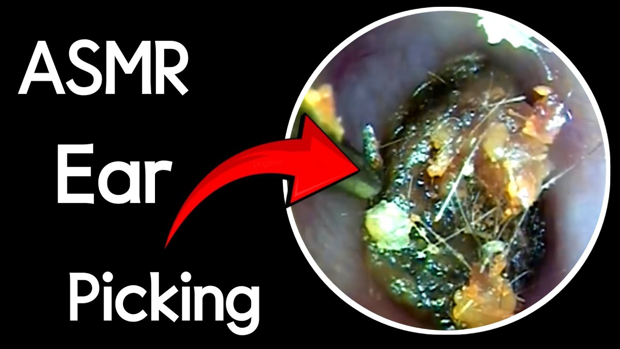 ASMR Ear Picking Video is So Amazing - Let's Enjoy It - YouTube