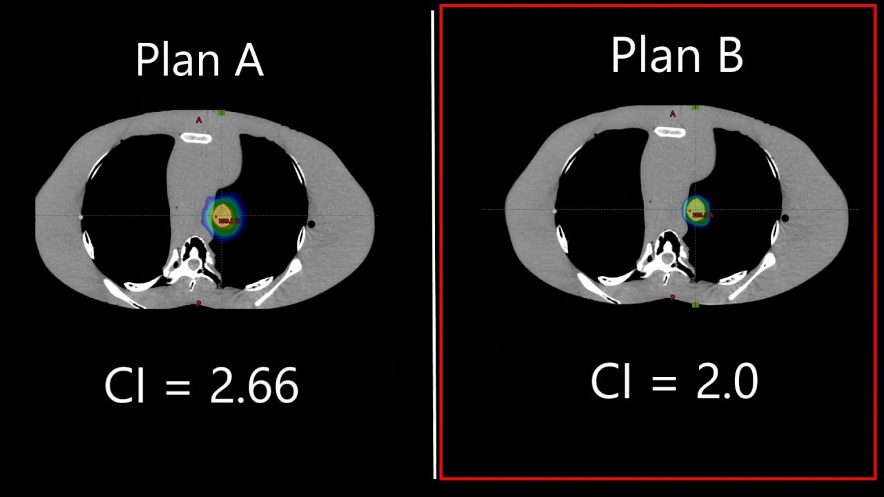 ClearCheck Conformity Index - YouTube