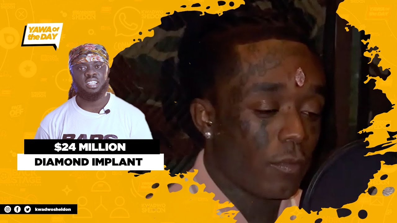 American Rapper Implants Pink Diamond Worth $24 Million In His Forehead ...
