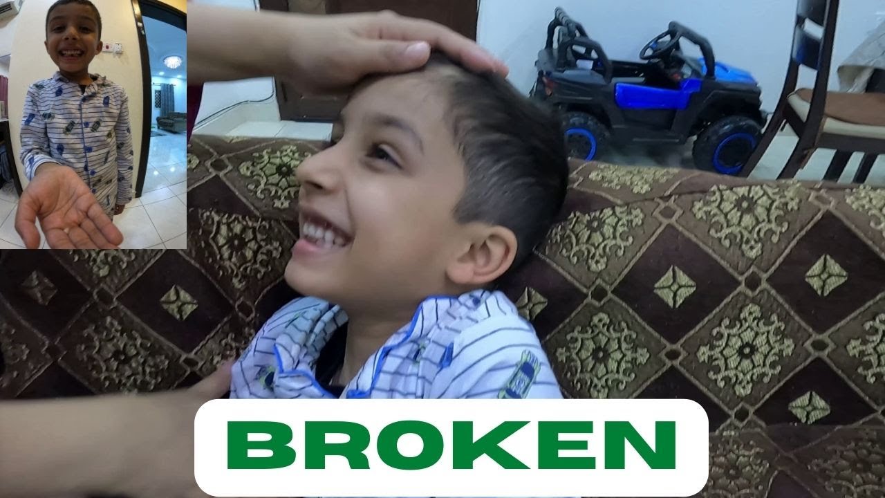 Muhammad Haseeb Teeth Broken - YouTube