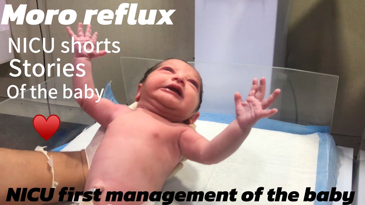 Newborn Baby First Management in NICU | Moro Reflex Explained #NICUBaby ...