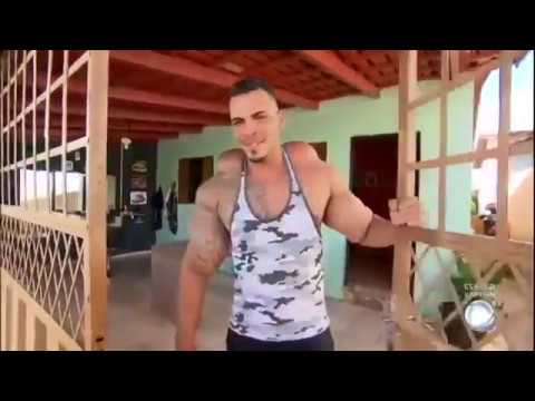 Bodybuilders Inject Muscles With Oil (Synthol) - YouTube
