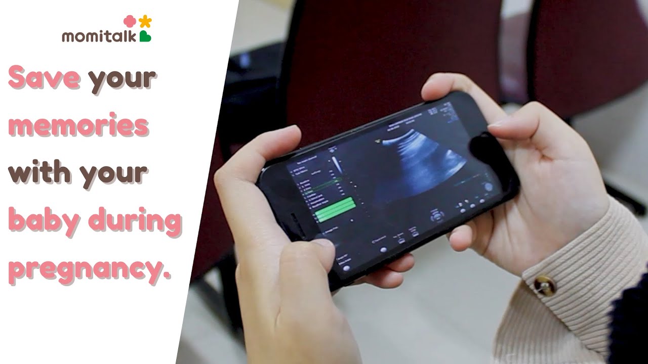Meet your baby in the ultrasound video from your smartphone!📲- For all ...