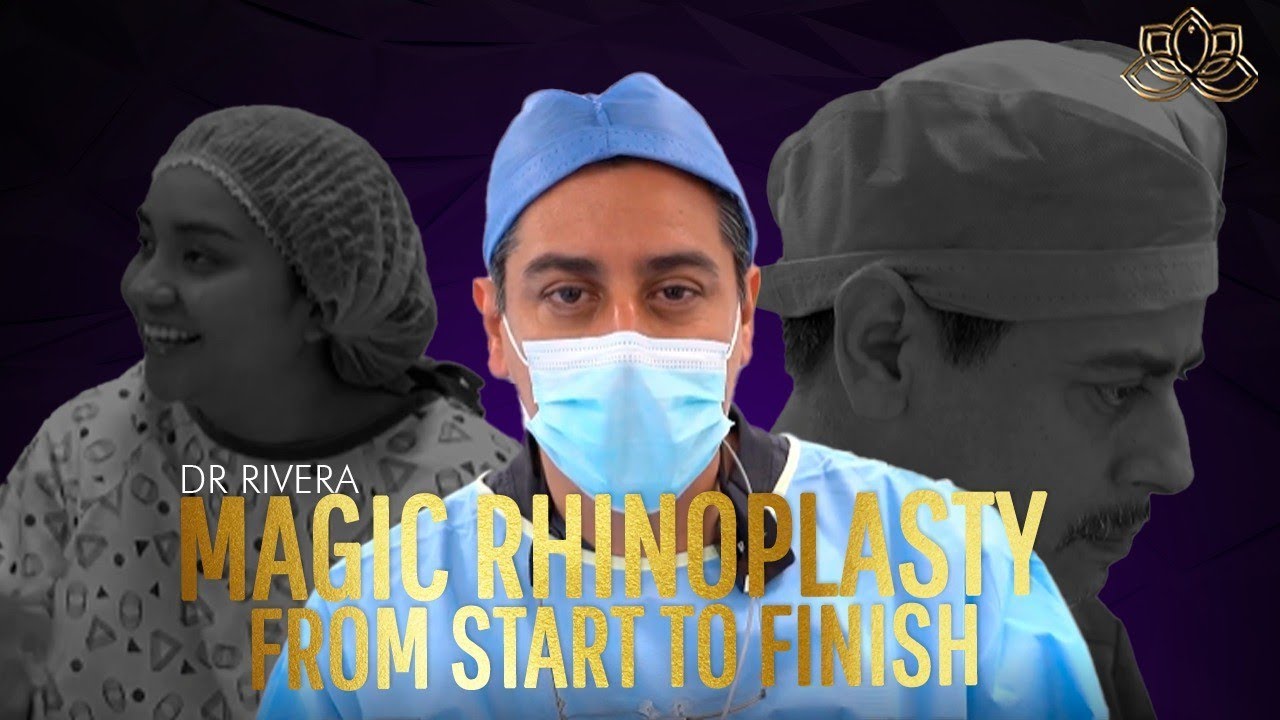 Great Rhinoplasty Results by Dr Rivera! Watch to witness double results ...