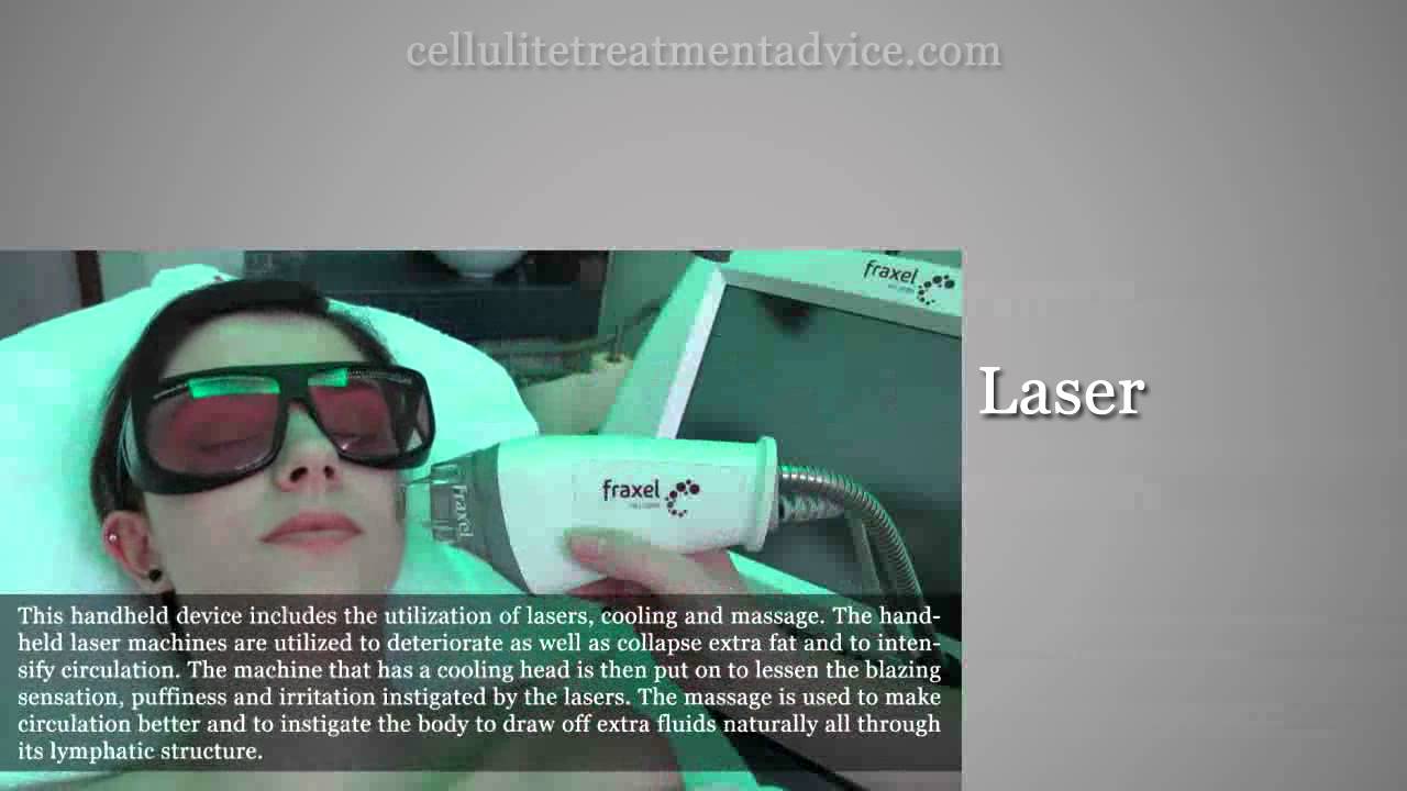 How to Use Handheld Cellulite Reduction Machines at Home.flv - YouTube