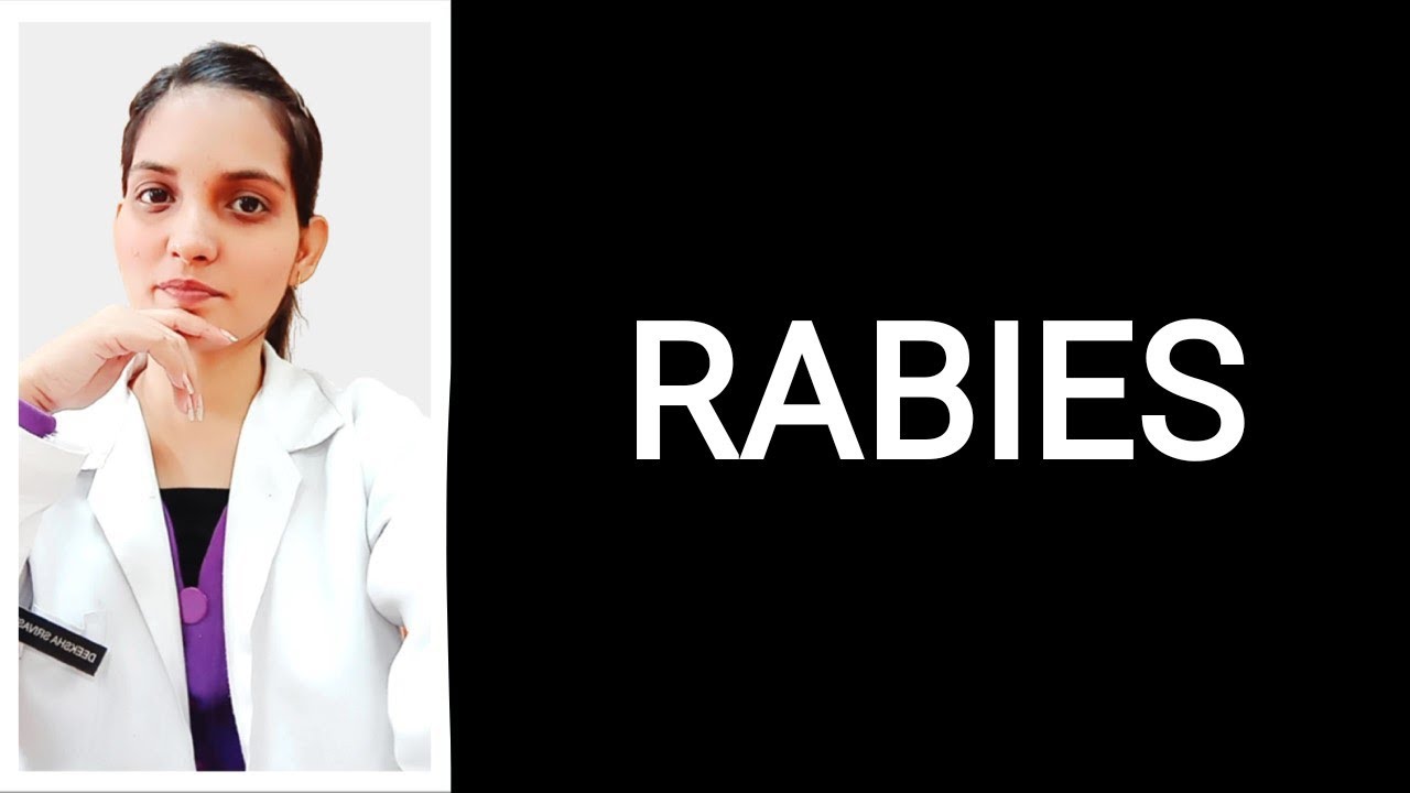 ||RABIES||EXPLAINED WITH HANDWRITTEN NOTES||PM LECTURE ||Dr. Deeksha ...