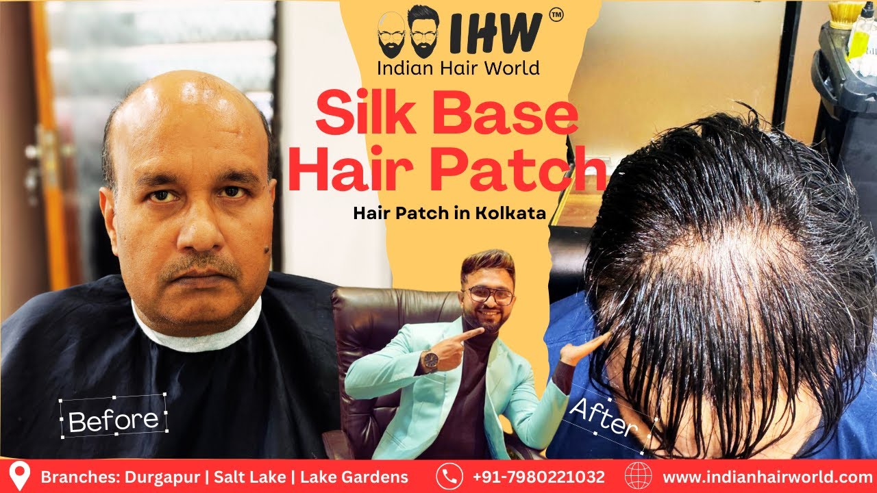 Silk Base Hair Patch: Best Non-Surgical Hair Patch in Kolkata | Indian ...