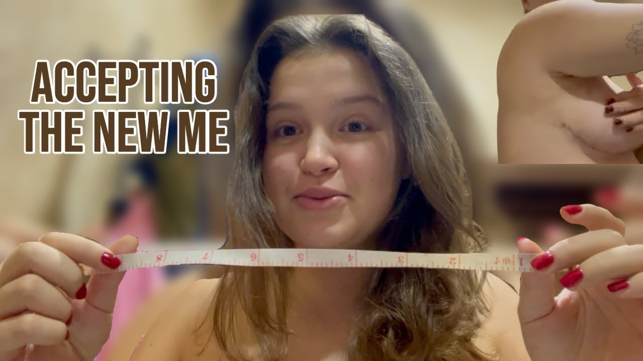 Breast Reduction Journey Part 4 Youtube