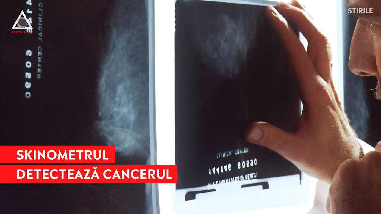 Cum este detectat cancerul de piele în UK - YouTube