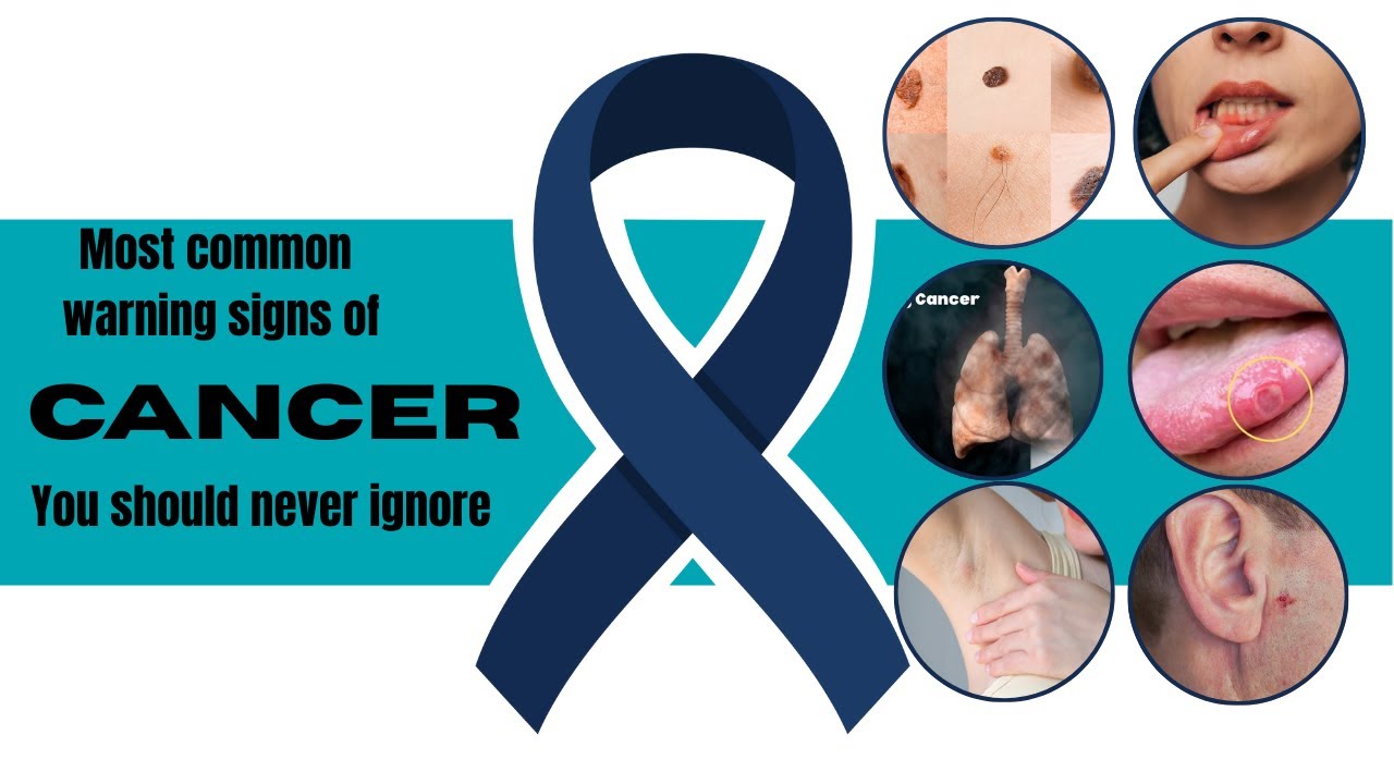 10 Cancer Warning Signs You Should NEVER Ignore | Early Detection Saves ...