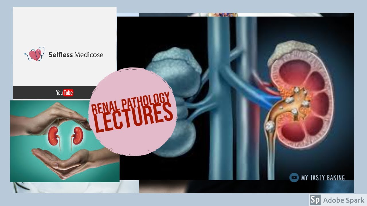 RENAL PATHOLOGY lecture 16 NEPHROSCLEROSIS - YouTube