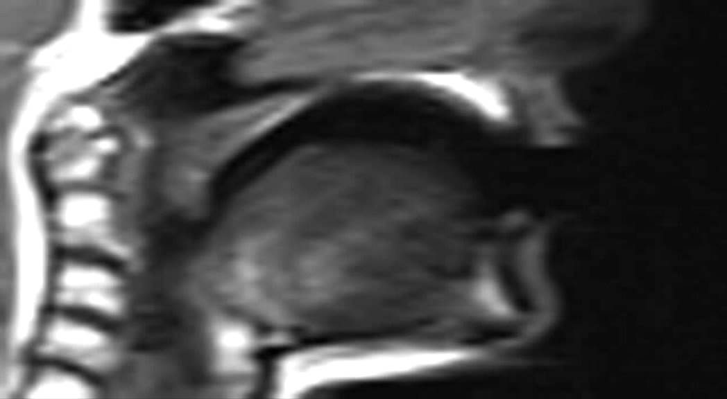 Ultrax MRI vd labial velar approximant - YouTube