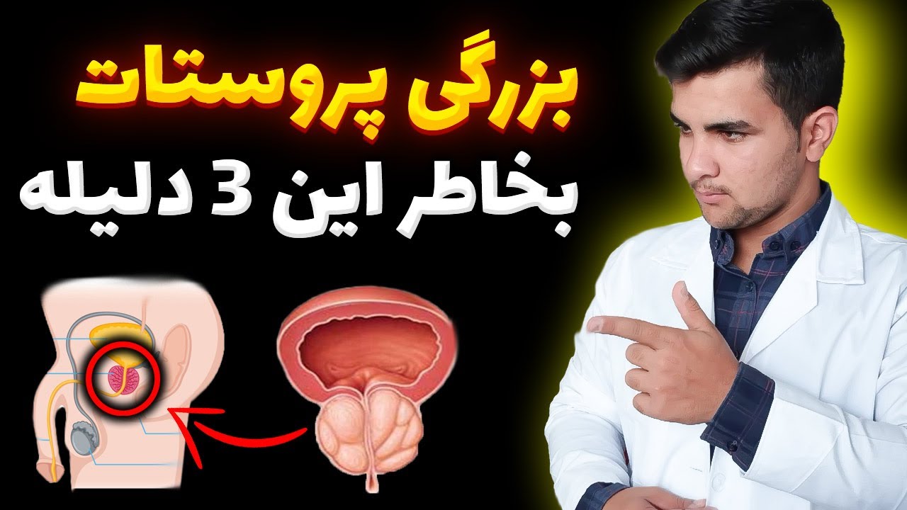 دلایل بزرگ شدن پروستات The Causes Of Prostate Enlargement Youtube