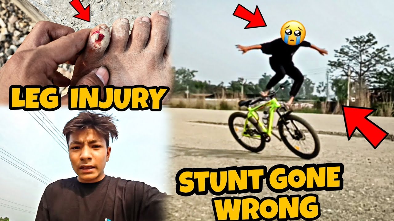 Leg Injury 🤕 || Stunt Gone Wrong 😭 - YouTube