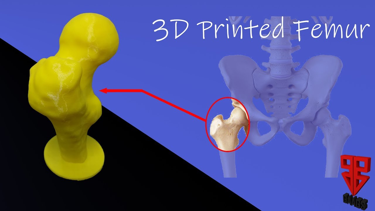 3D PRINTED FEMUR @3dgaags - YouTube