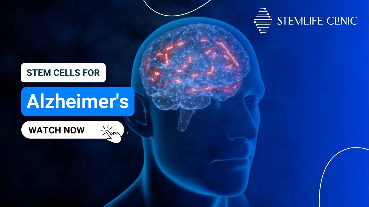 Stem Cell Therapy for Alzheimer's | The science behind the promise ...
