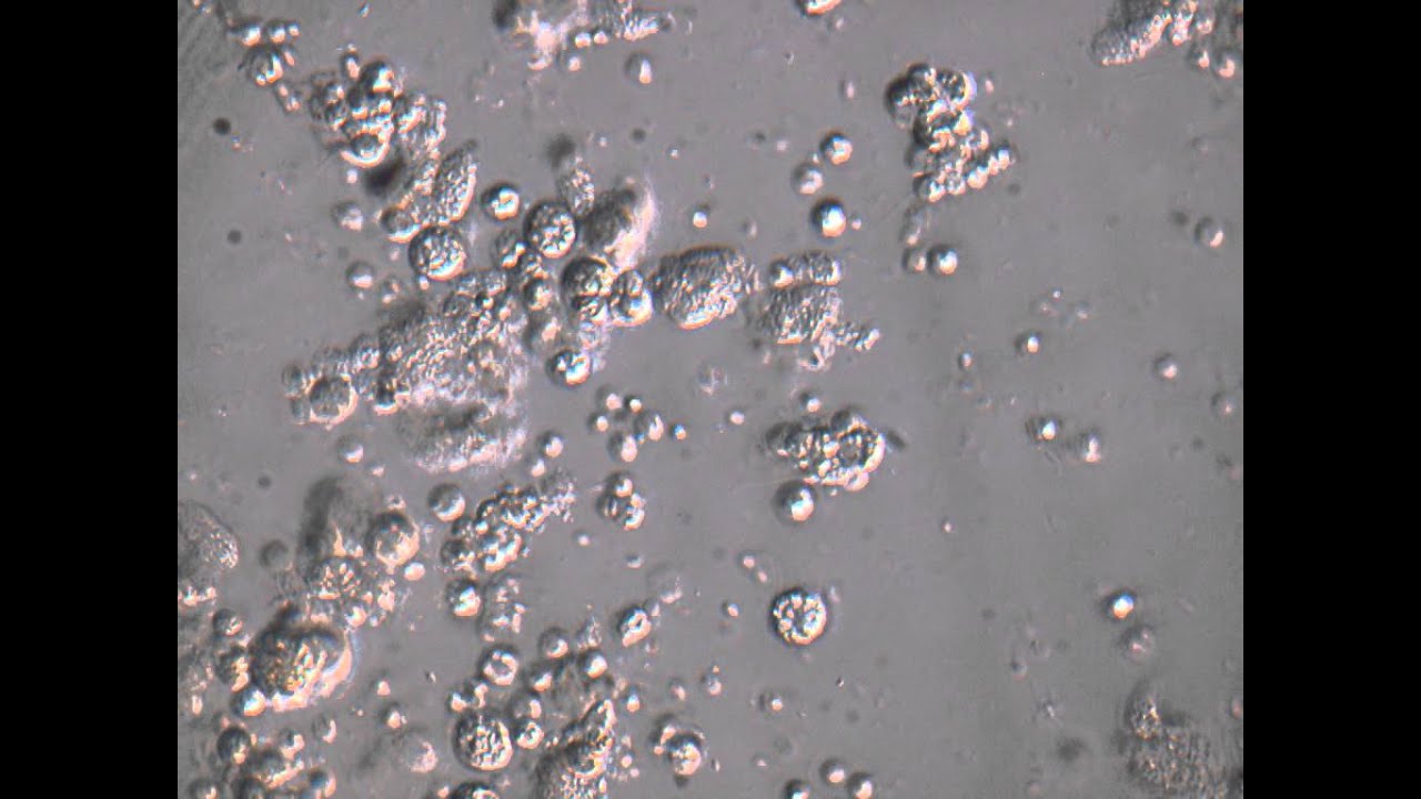Sponge Cells Aggregation - YouTube