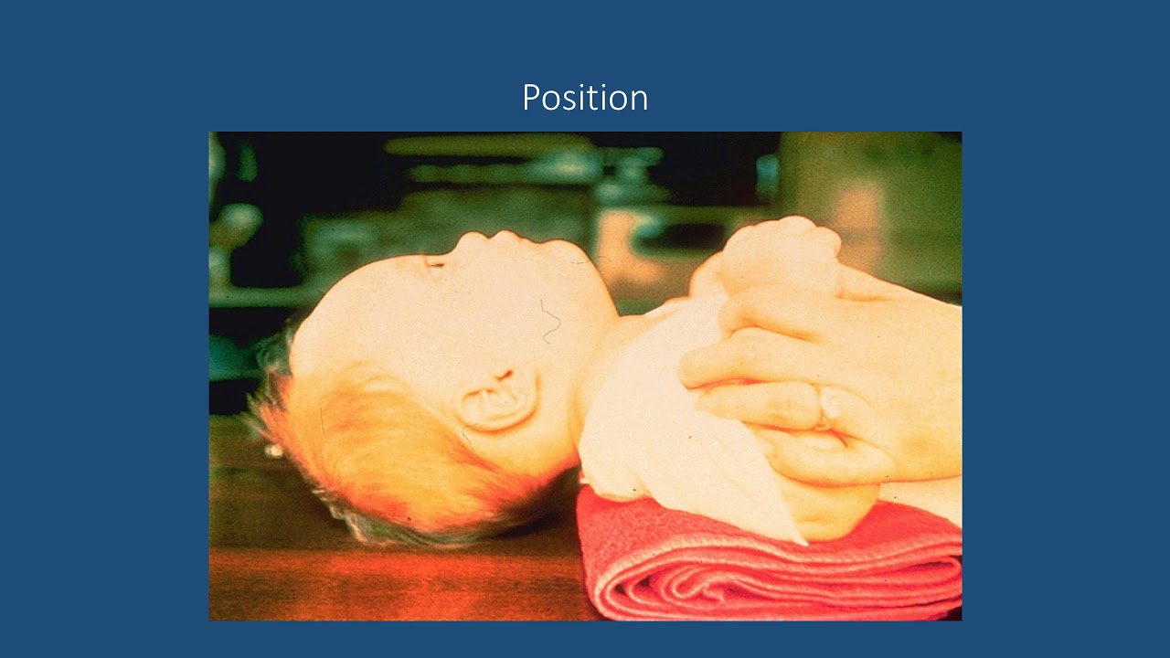 Neonatal Intubation training video - YouTube