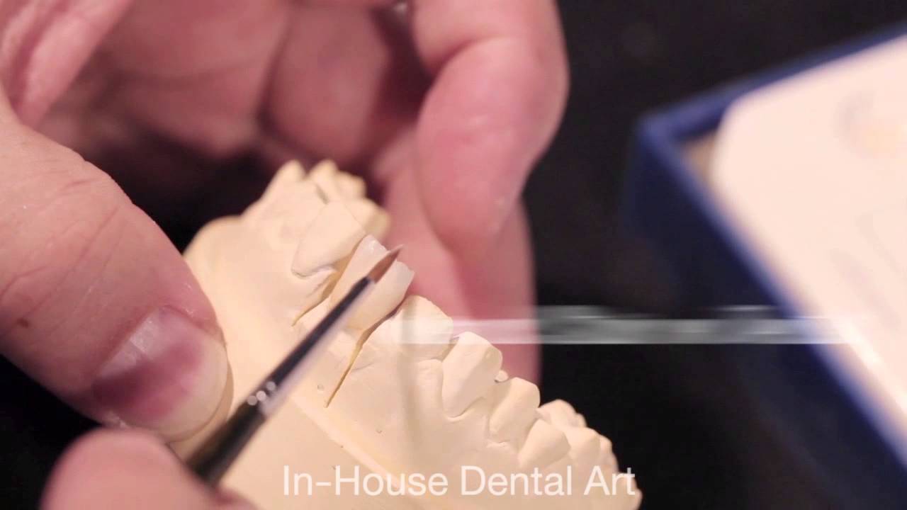 Internal Stain By In House Dental Art - YouTube