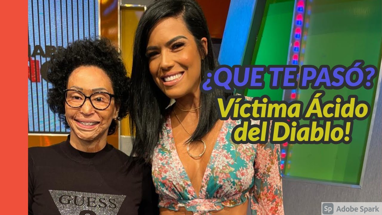 INCREIBLE Y EMOTIVA HISTORIA SOBRE VICTIMA ACIDO DEL DIABLO! - YouTube