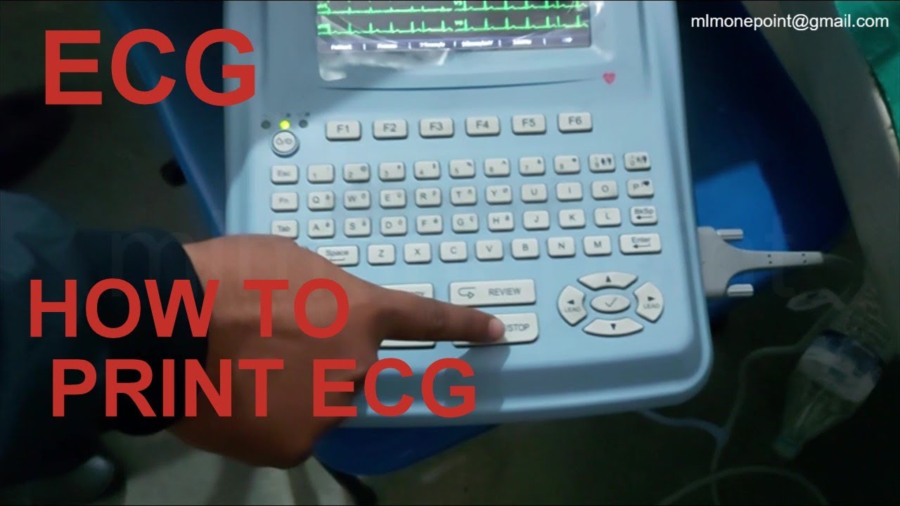 PRINTING ECG- HOW TO DO ECG ; कैसे प्रिंट करें ? - YouTube