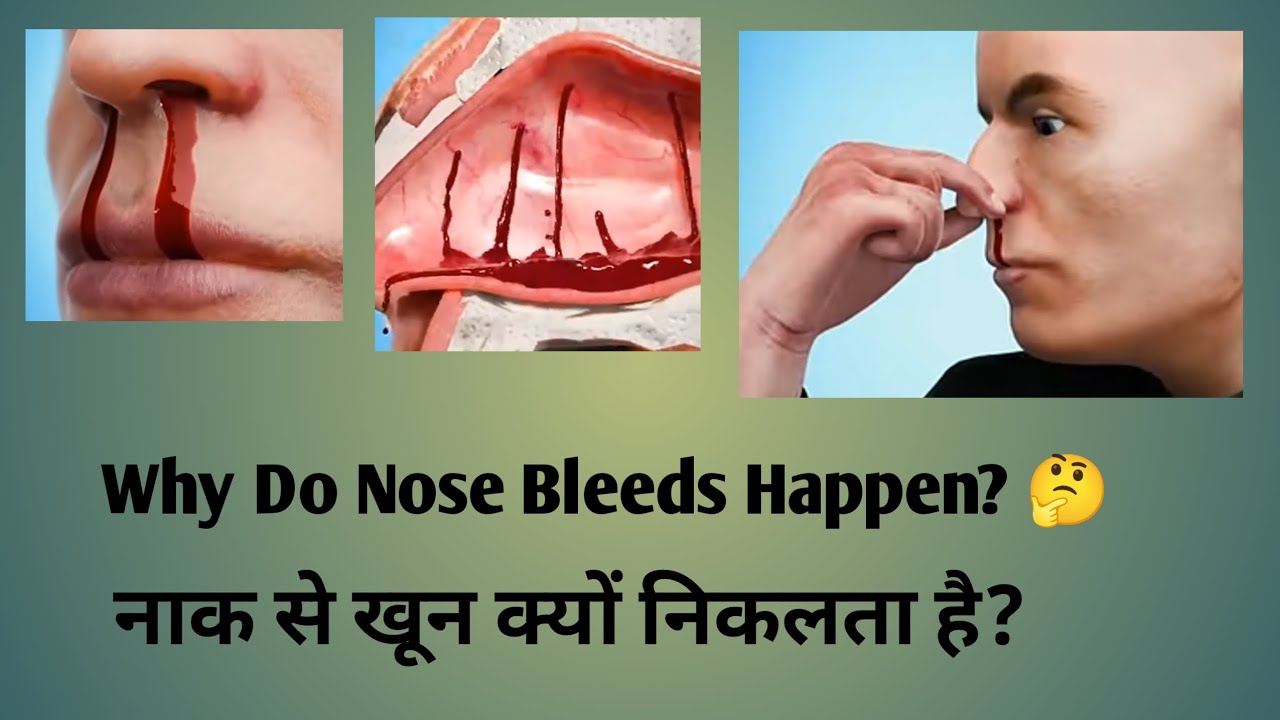 Why Do Nose Bleeds Happen? 🤔 #video #viral #3danimation @zackdfilms ...