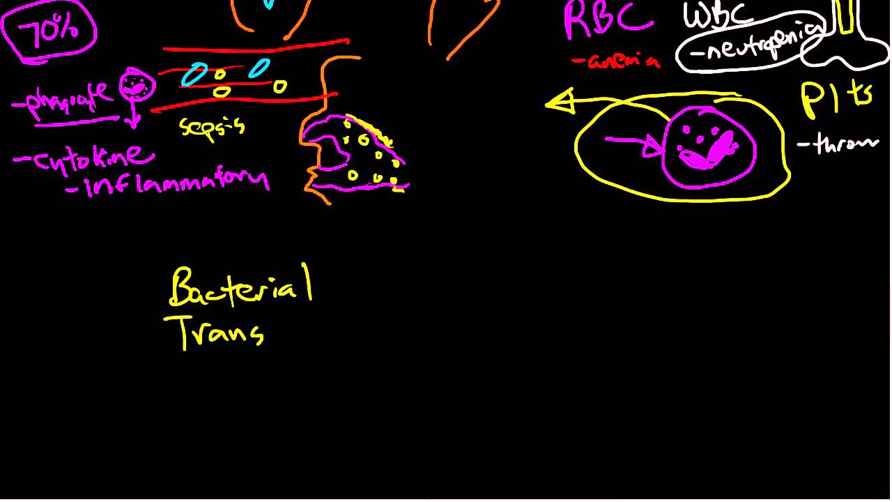 Sepsis Pathophysiology Nursing
