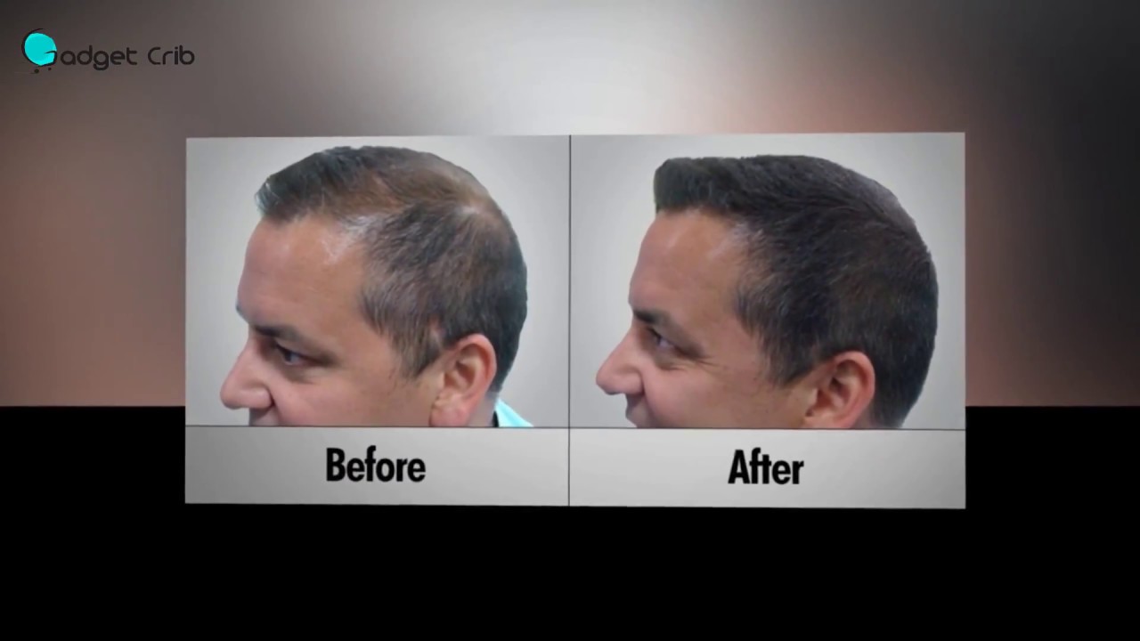 Power Grow Best Laser Treatment Comb Kit For Hair Loss & Regrowth - YouTube