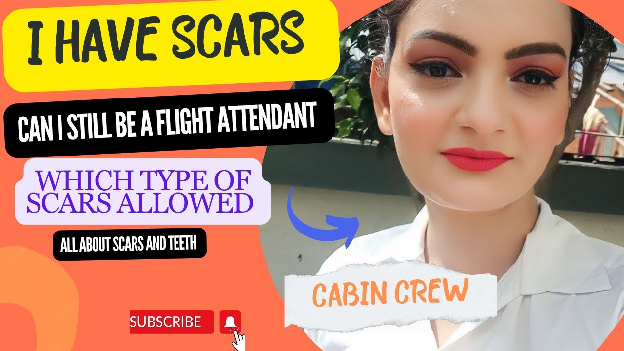 I HAVE SCARS CAN I STILL BE A CABIN CREW? #cabincrew #youtube # ...