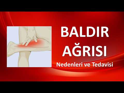 BALDIR AĞRISI Nedenleri ve Tedavisi