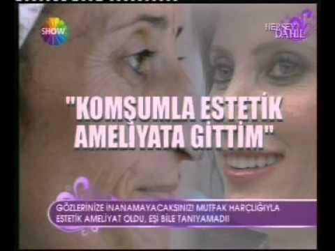 Burun estetiğinden sonra eşi bile tanıyamadı - Çağla Şıkel