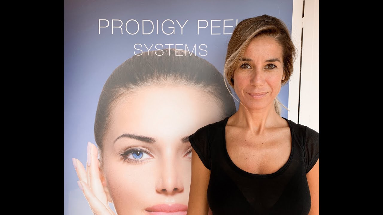 Prodigy Peel Systems - YouTube