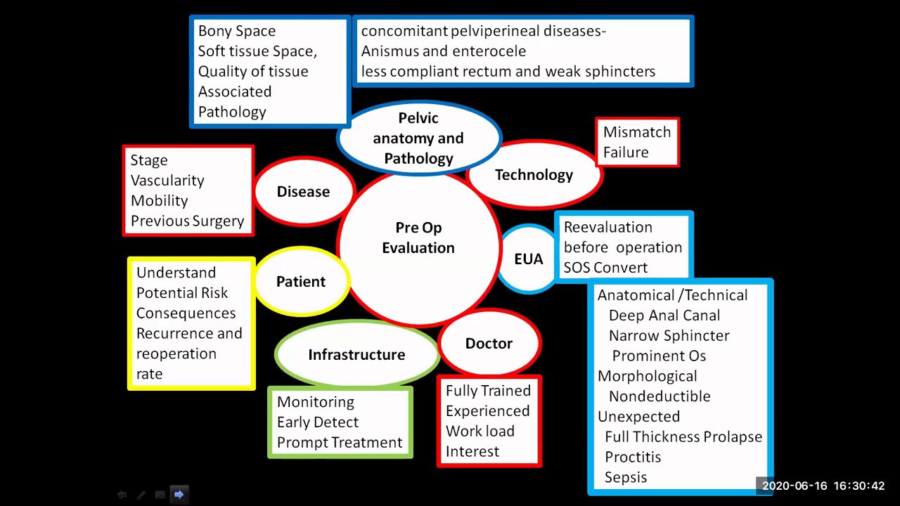 Hemorrhoids / piles - PPH Procedure, Stapled Hemorrhoid Surgery Pre op ...