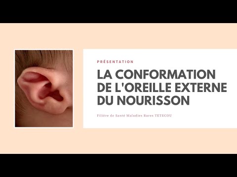 La conformation de l'oreille externe du nourrisson - YouTube