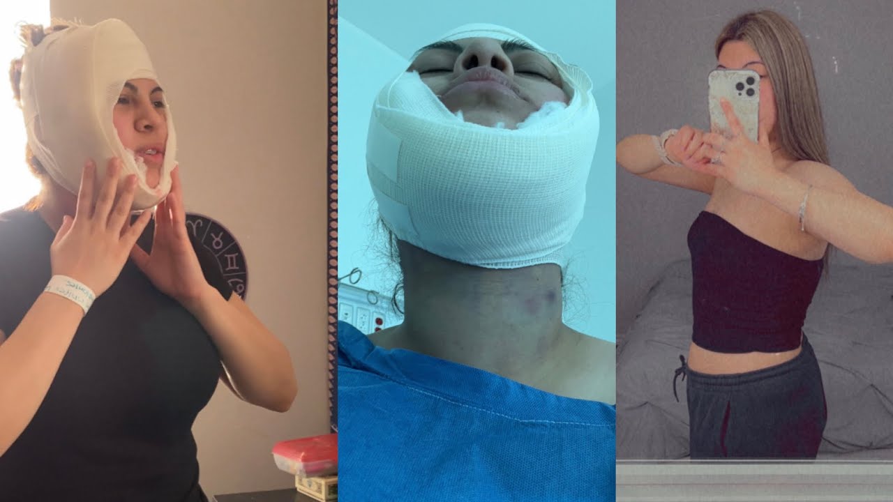 Mi Hermana Se OperÓ Youtube