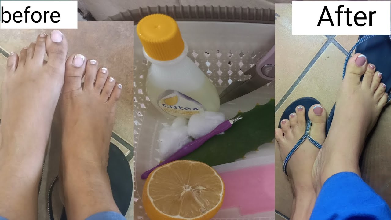 Tan Remove + Feet Whitening Pedicure At Home (Live Demo) Super Style ...