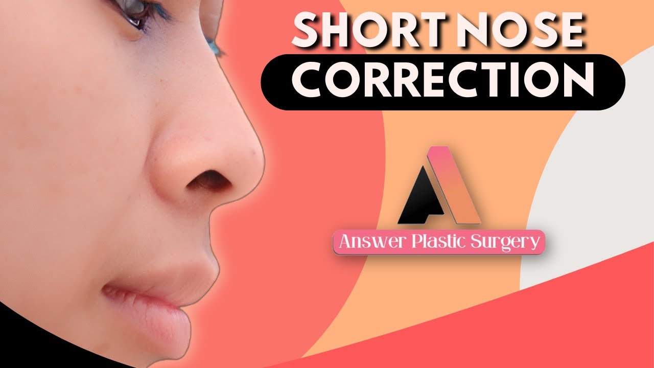 Short Nose Correction | Answer Plastic Surgery - YouTube