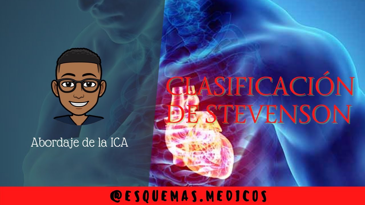 INSUFICIENCIA CARDÍACA ¡CLASIFICACIÓN DE STEVENSON EN 6 MINUTOS! - YouTube