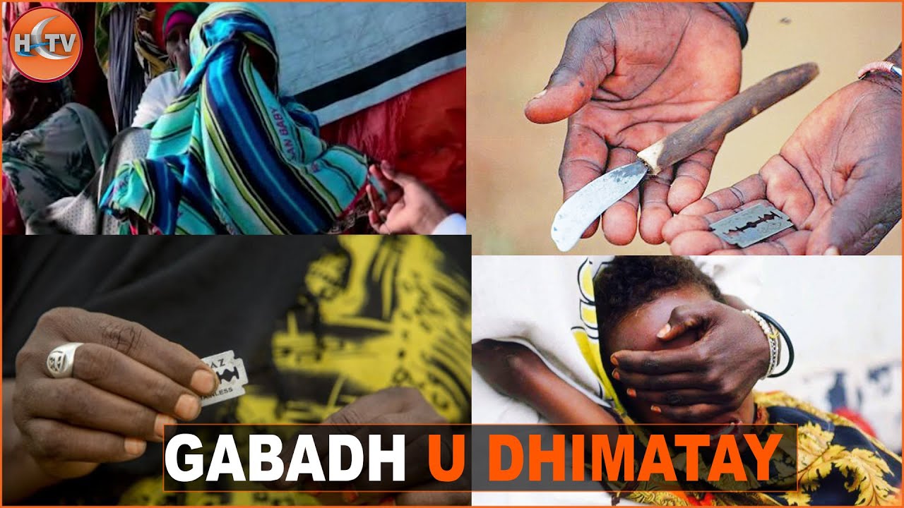 Gaalkacyo: Gabadh 14-Jir Ah Oo U Geeriyootay Gudniin Lagu Sameeyay ...