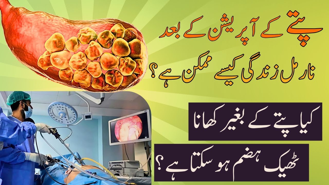 Can YOU Live a NORMAL Life after Gallbladder REMOVAL | Laparoscopic ...