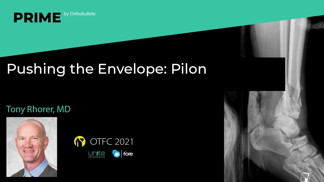 Pushing the Envelope: Pilon - Tony Rhorer, MD - YouTube