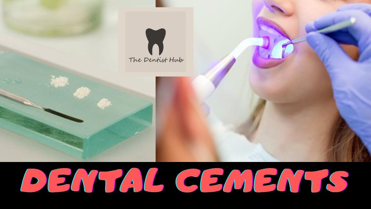 Introduction to Dental Cements | Dental Materials - YouTube