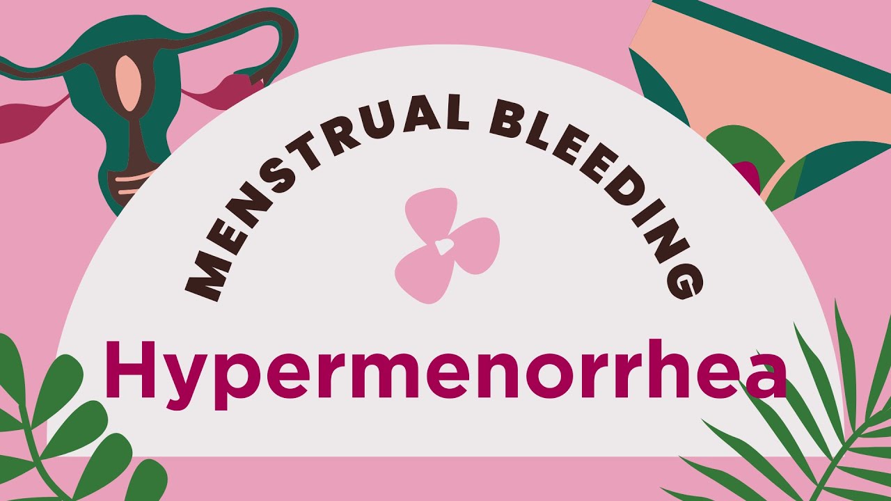 #Hypermenorrhea (Heavy Menstrual Bleeding): Causes, Symptoms, and ...
