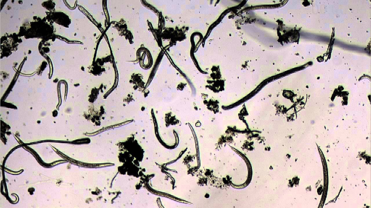 Nematodes under microscope - YouTube