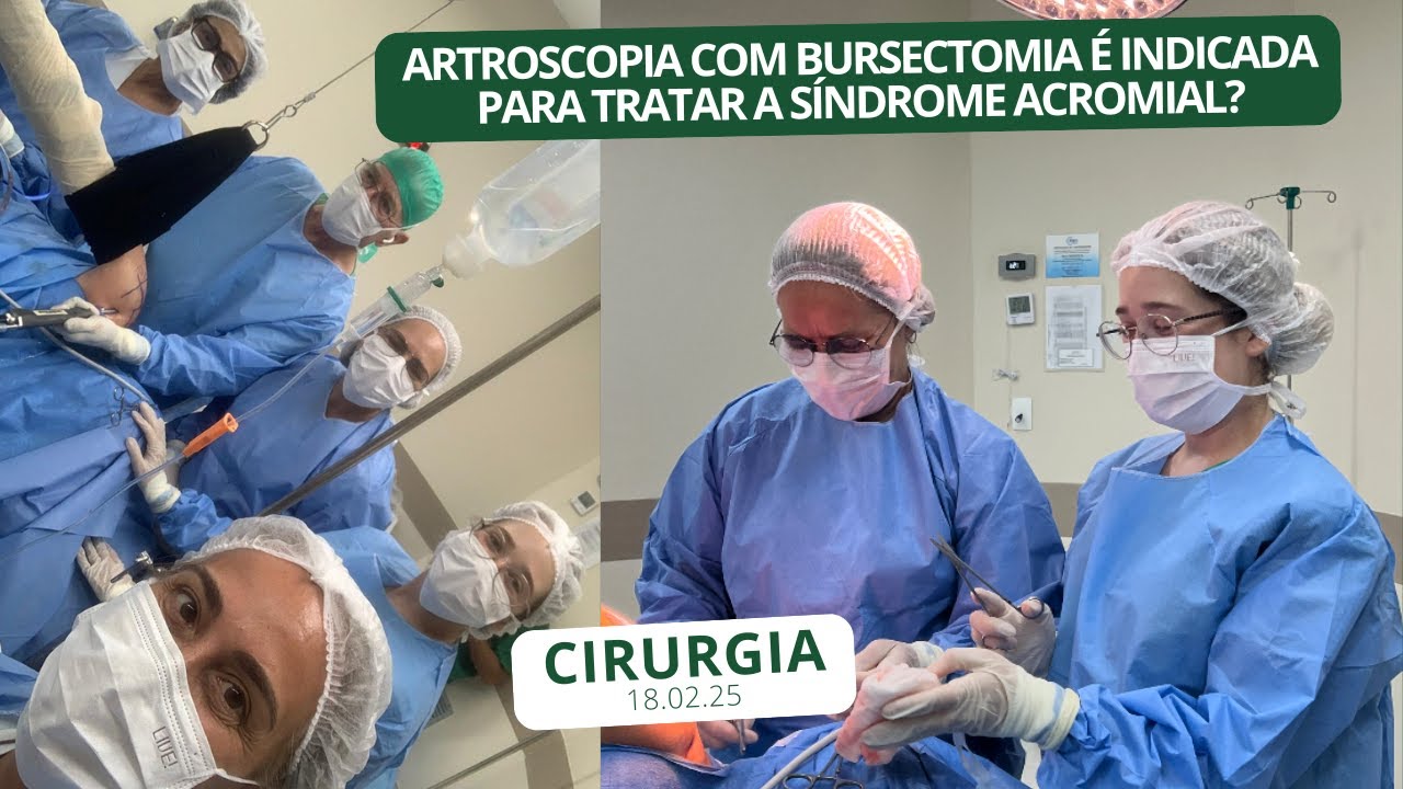 Artroscopia com Bursectomia é indicada para tratar a síndrome acromial ...
