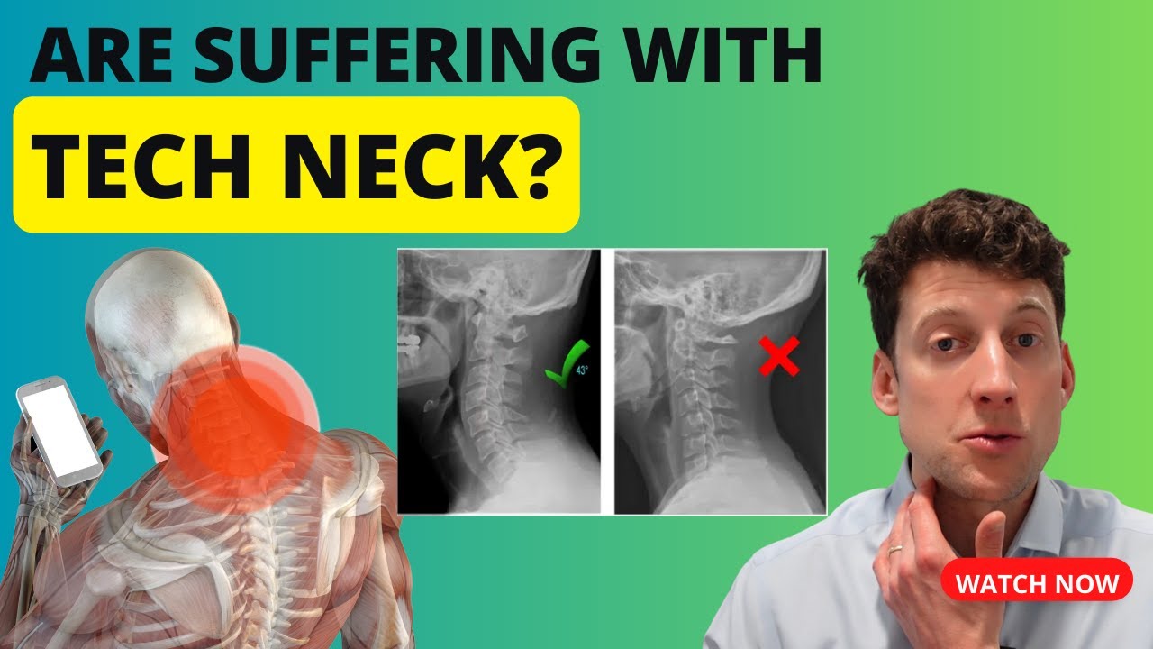 What is "tech neck" and how to FIX it? - YouTube
