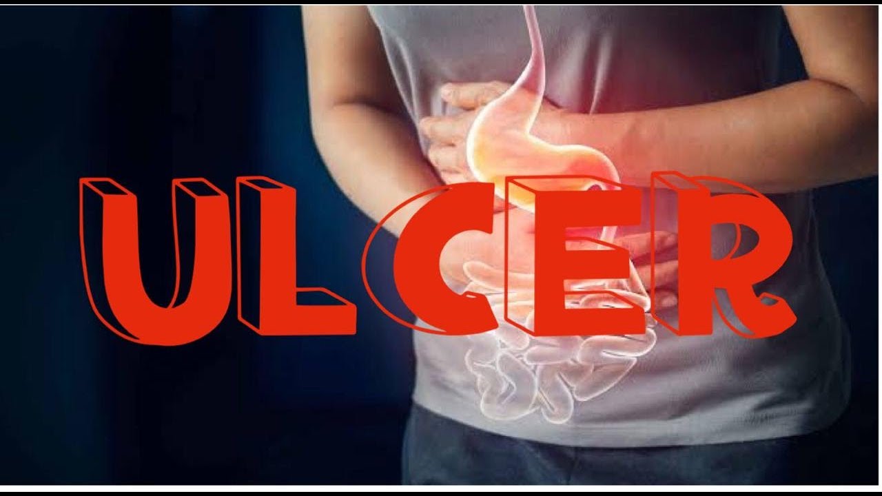 Ulcer | inflammatory bowel diseases | causes | pathology ...